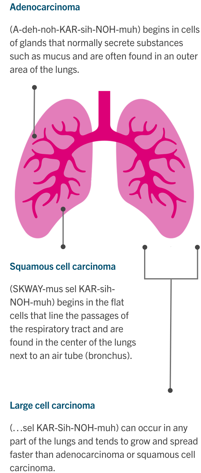 What is Advanced NSCLC? | LIBTAYO® (cemiplimab-rwlc)
