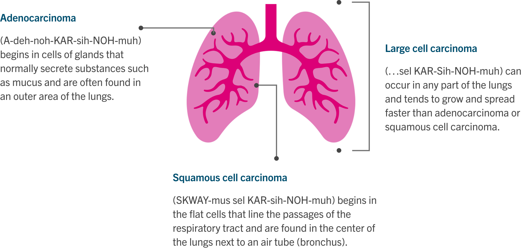 What is Advanced NSCLC? | LIBTAYO® (cemiplimab-rwlc)