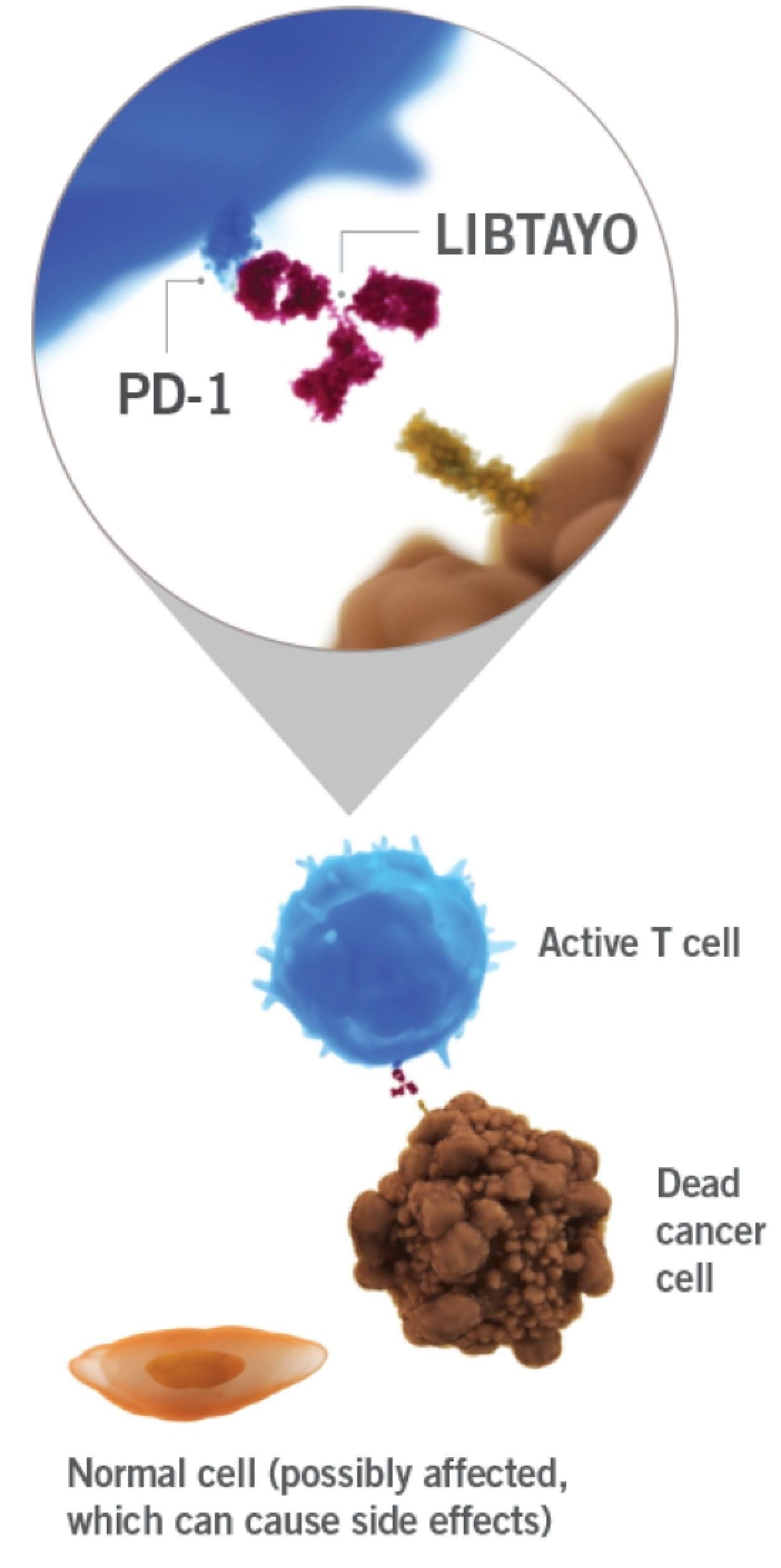 What is LIBTAYO® (cemiplimab-rwlc) | Advanced CSCC